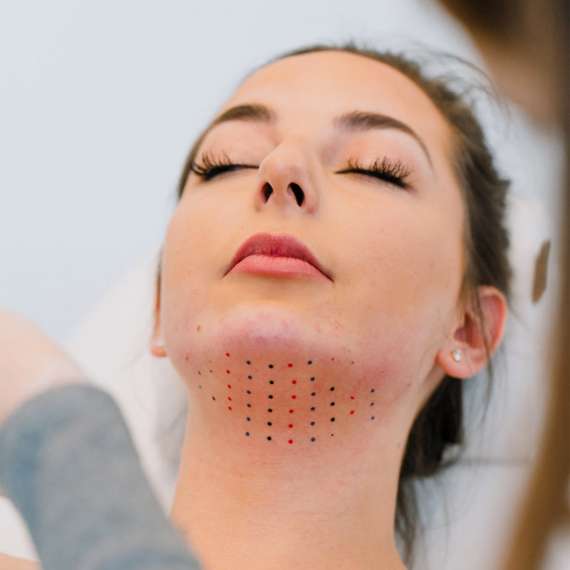 The Truth About Botox - Styled to Sparkle